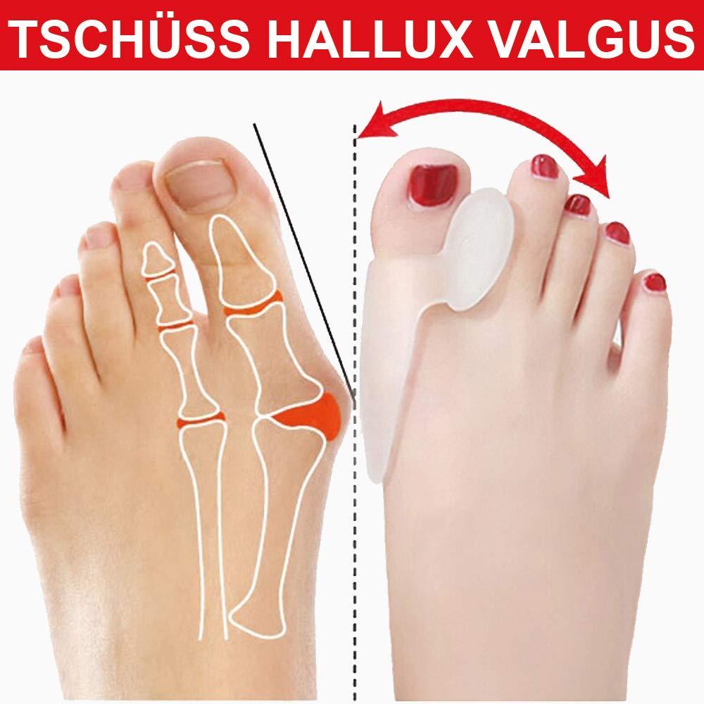 Halluxe Valgus Toe Spreader for Men & Women - 3 Pairs of Silicone ...