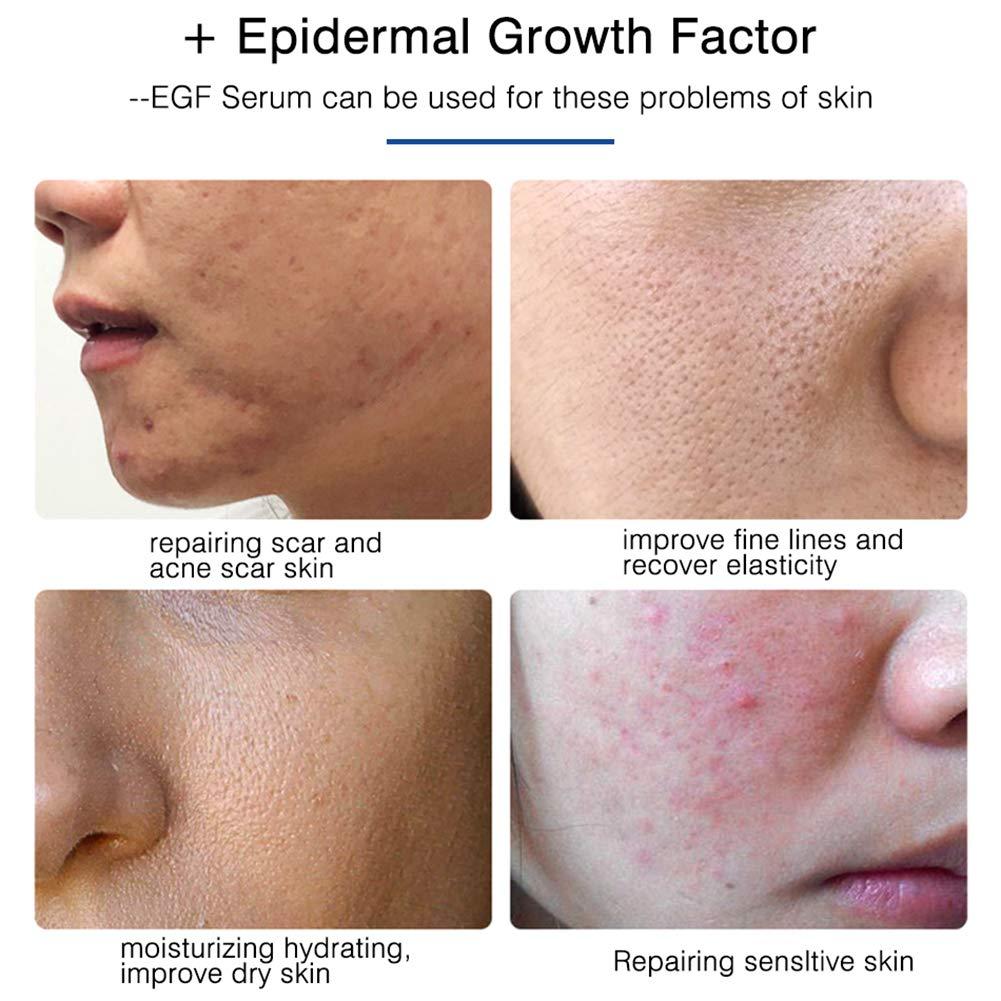 EGF Skin Rejuvenation Serum & Growth Factor Powder Kit | Moisturizing, Anti-Wrinkle ...