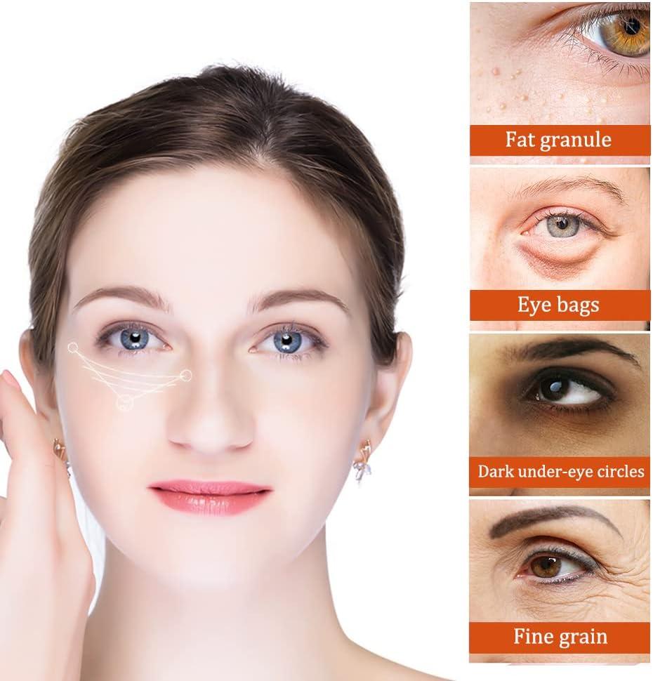 Remove Fat Particles Under Eyes Moisturizing Eye Essence Deeply ...