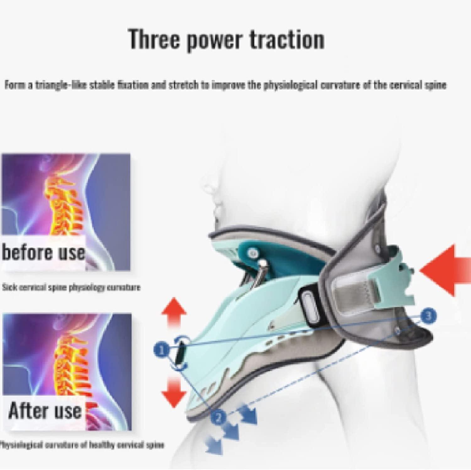 Ergonomic Cervical Traction Device - Relieve Neck Pain & Restore ...