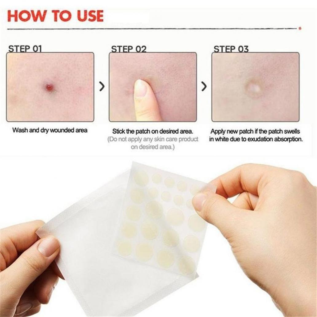 Connoworld 24 Patches Beauty Acne Patch Set - Pimple Treatment and ...