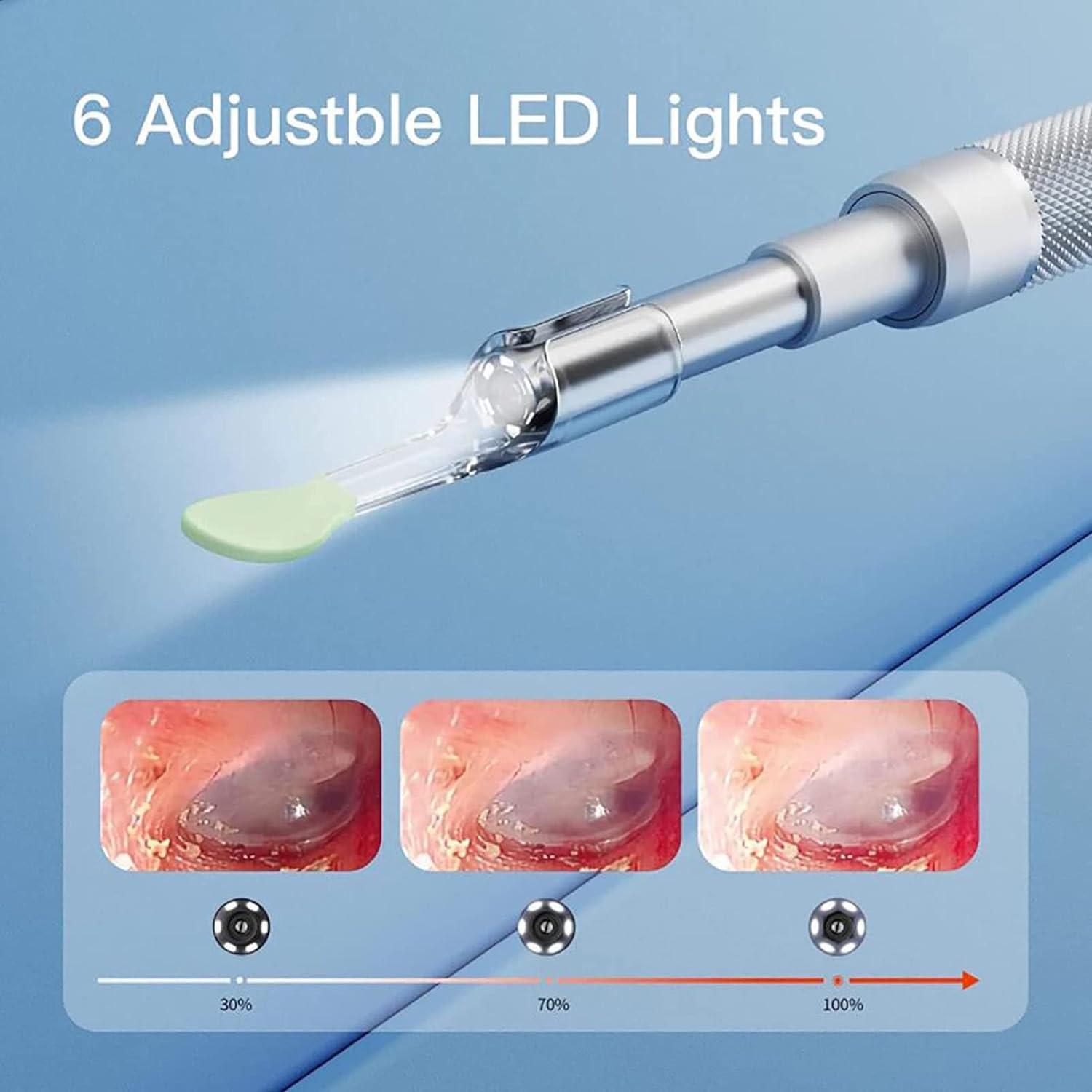 Visual Ear Spoon Endoscope with LED Lights - 7-inch HD Screen Otoscope ...