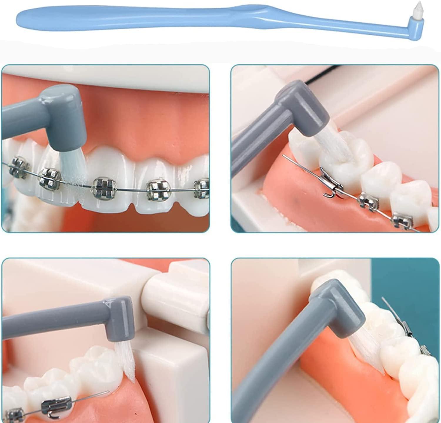 5 Pcs Interspace Toothbrushes - Orthodontic Interdental Brushes for ...
