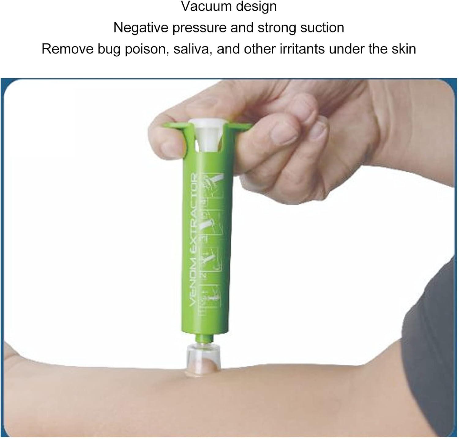 Touisedgi Venom Extractor Suction Tool - Bug Bite & Bee/Wasp Sting ...