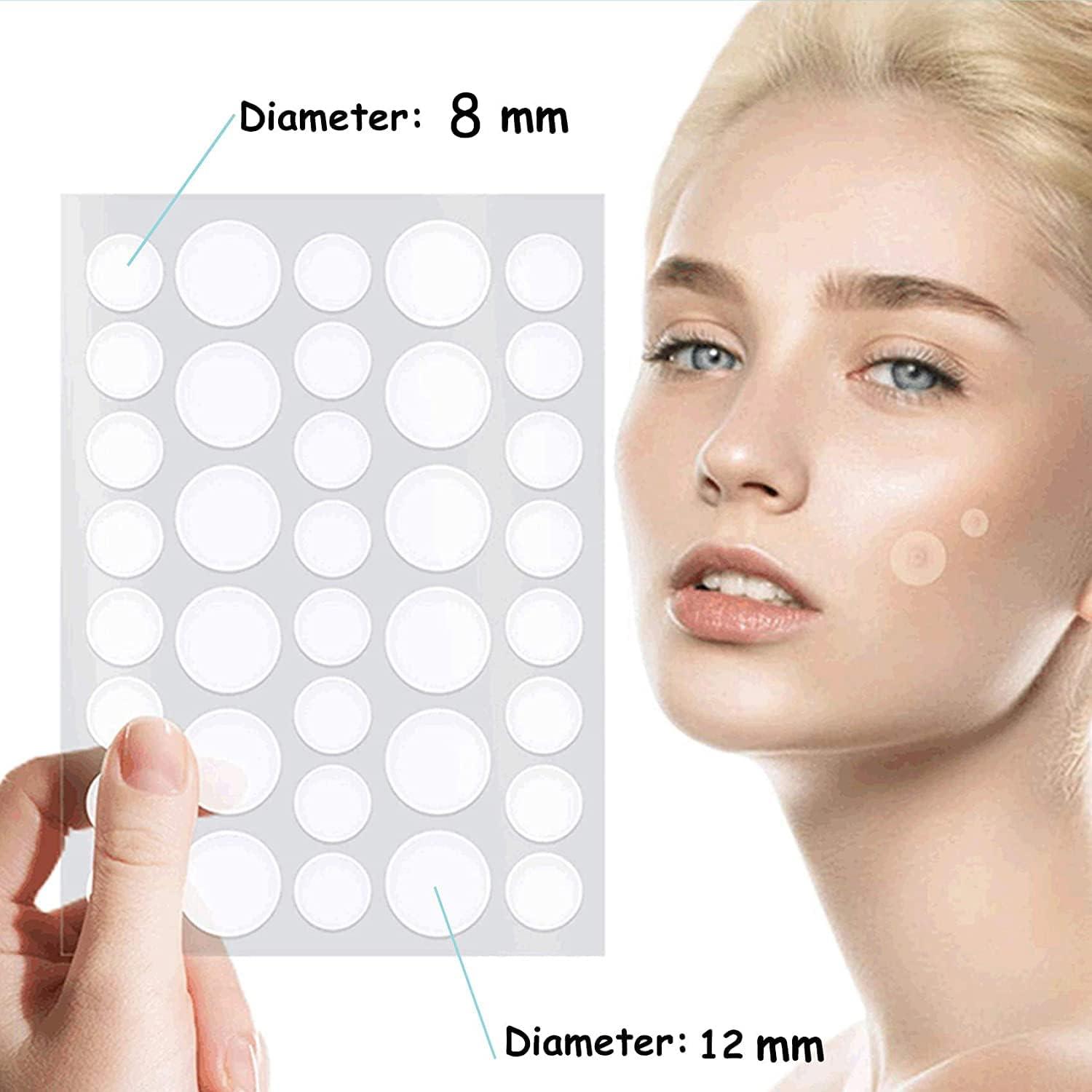 Rnitle Acne Patches 180 pcs Hydrocolloid Dressing Cover for Spots ...