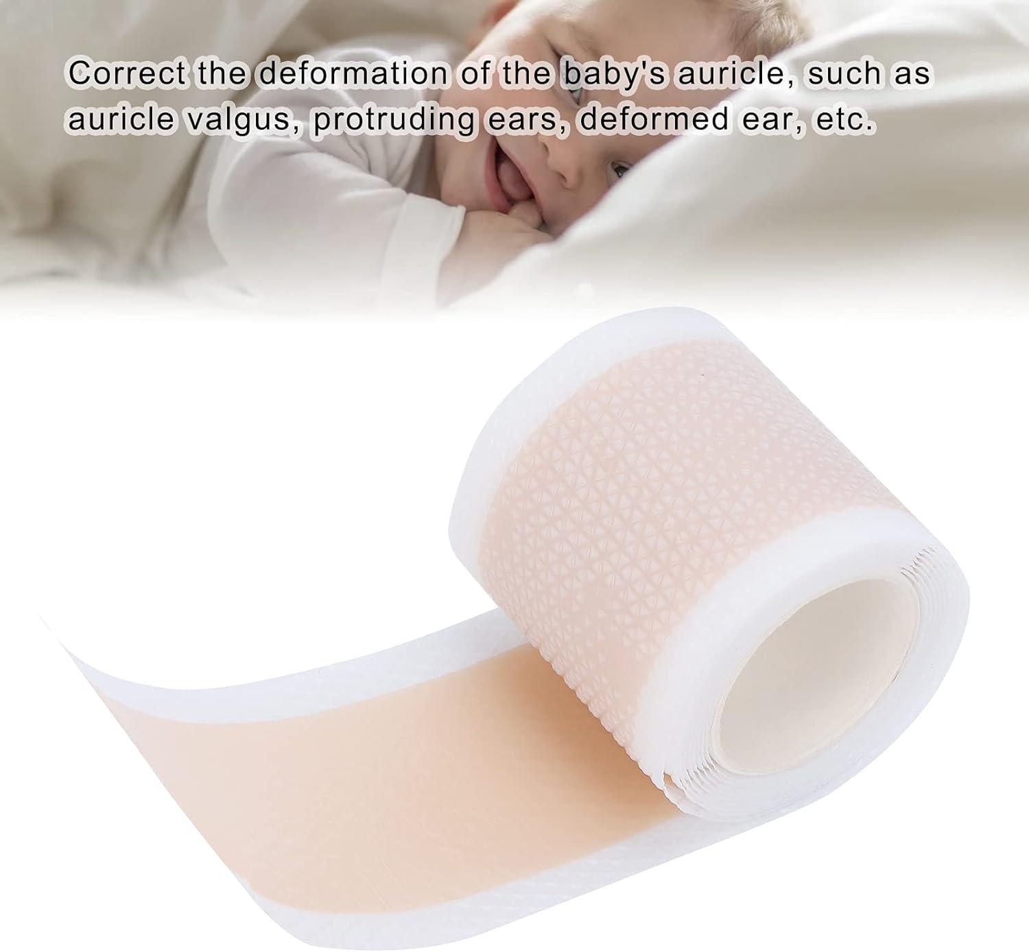 Silicone Baby Ear Corrections 1 Roll 4 X 100 Cm Baby Auricle Valgus ...