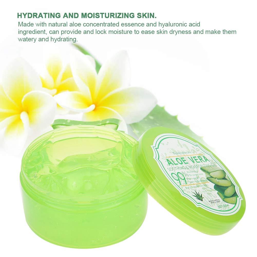 Organic Aloe Vera Gel 300g | Moisturizing for Damaged Skin Acne Scars ...