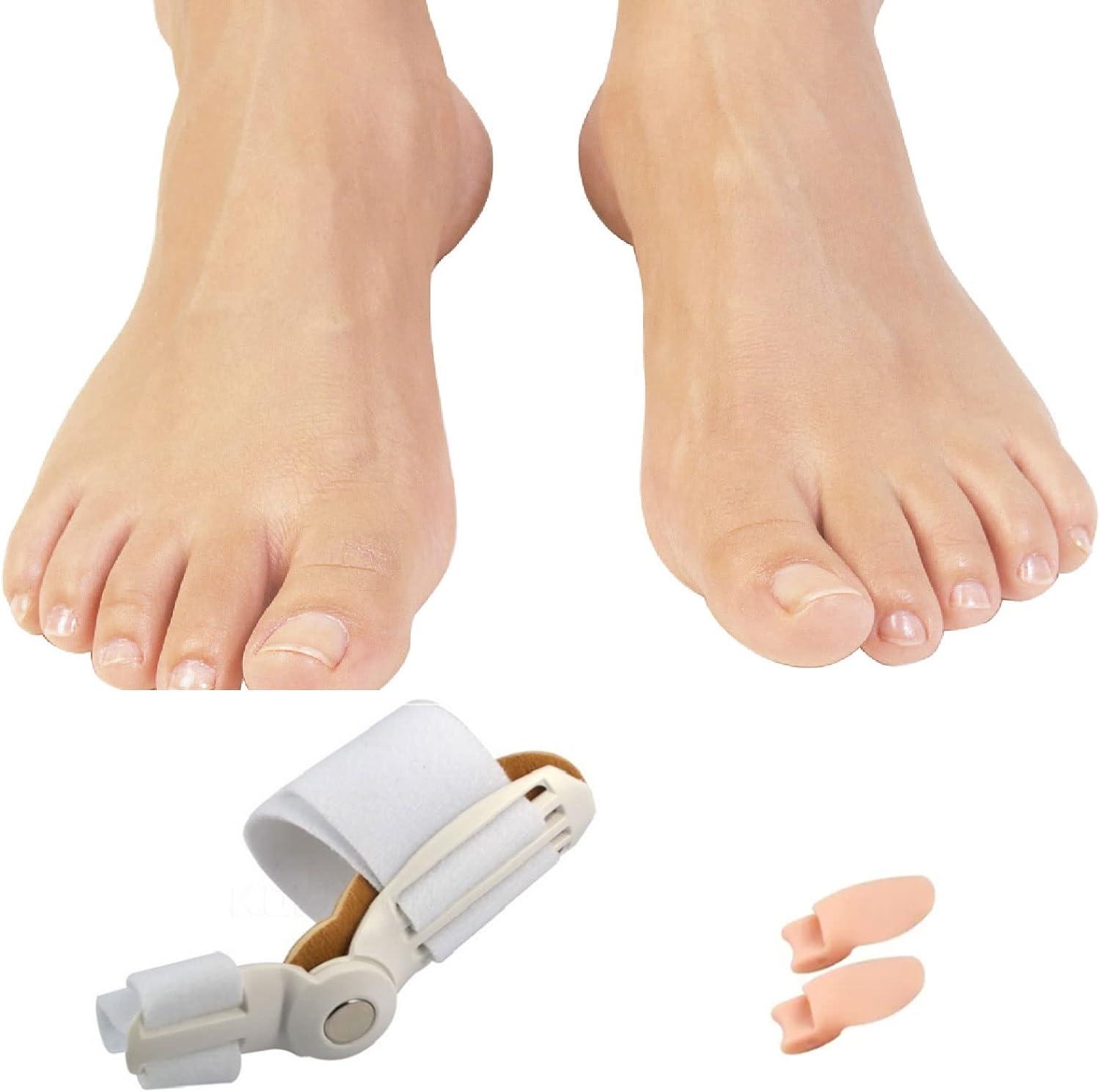Bunion Corrector Splints + Toe Separators Set for Hallux Valgus ...