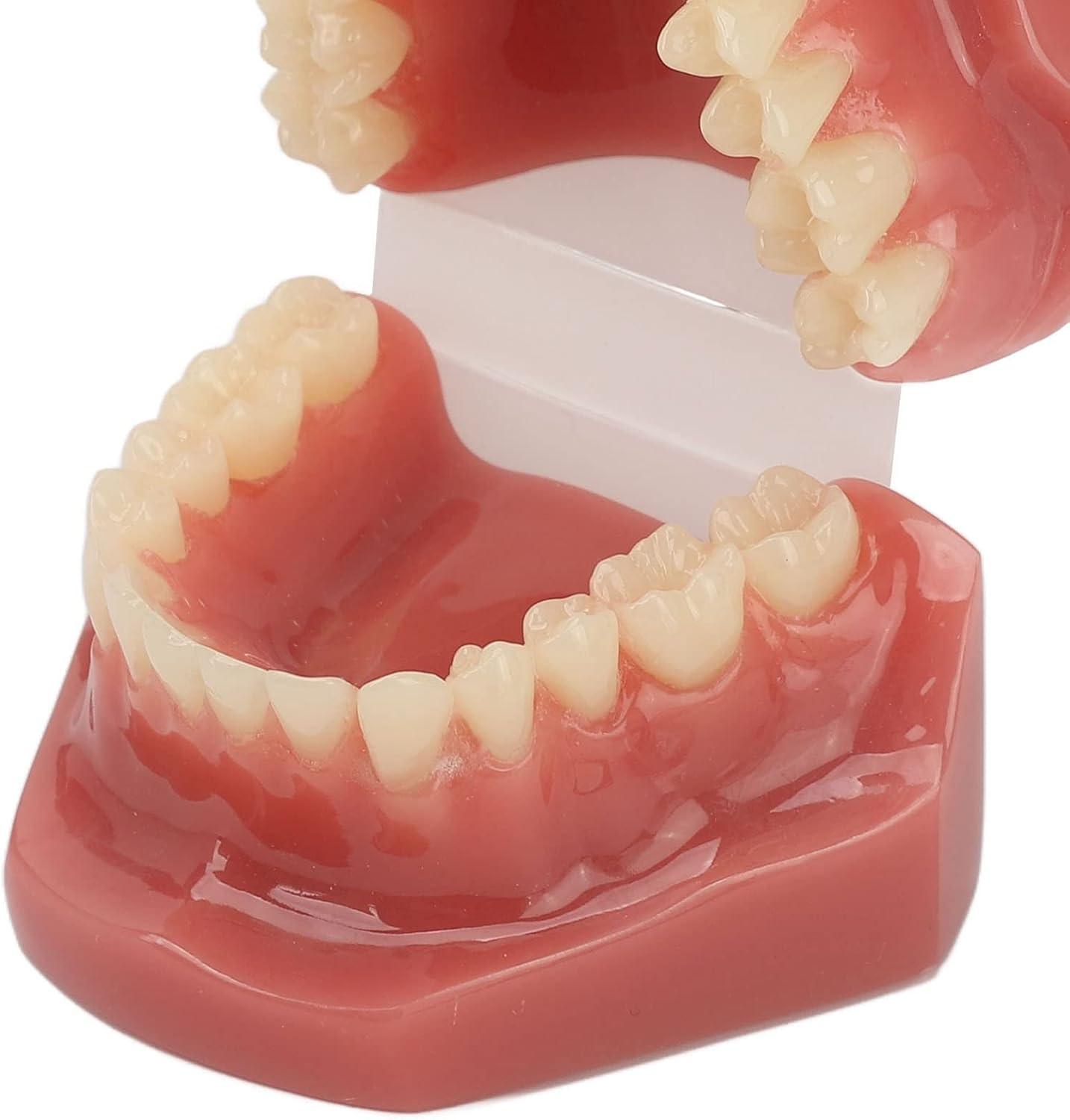 Teeth Demonstration Model - Orthodontic Mouth Training Reusable 28 ...
