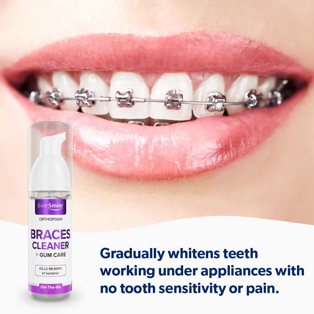 OrthoFoam Braces Cleaner - 1.69 Fl Oz - Whiten Teeth & Fight Plaque ...
