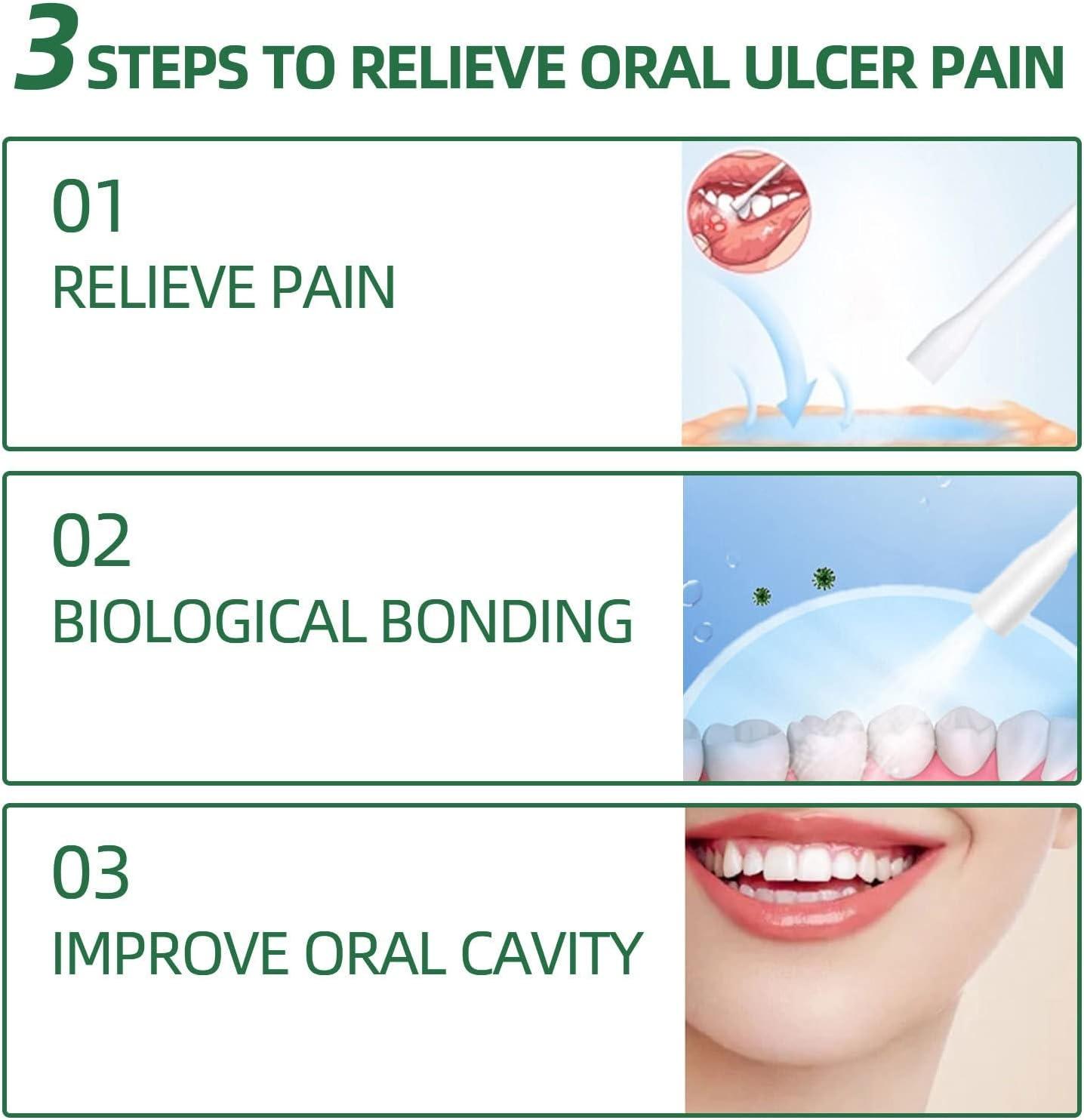 Ulcer Relief Herbal Mouth Spray 20ml - Antiviral Treatment for Canker ...