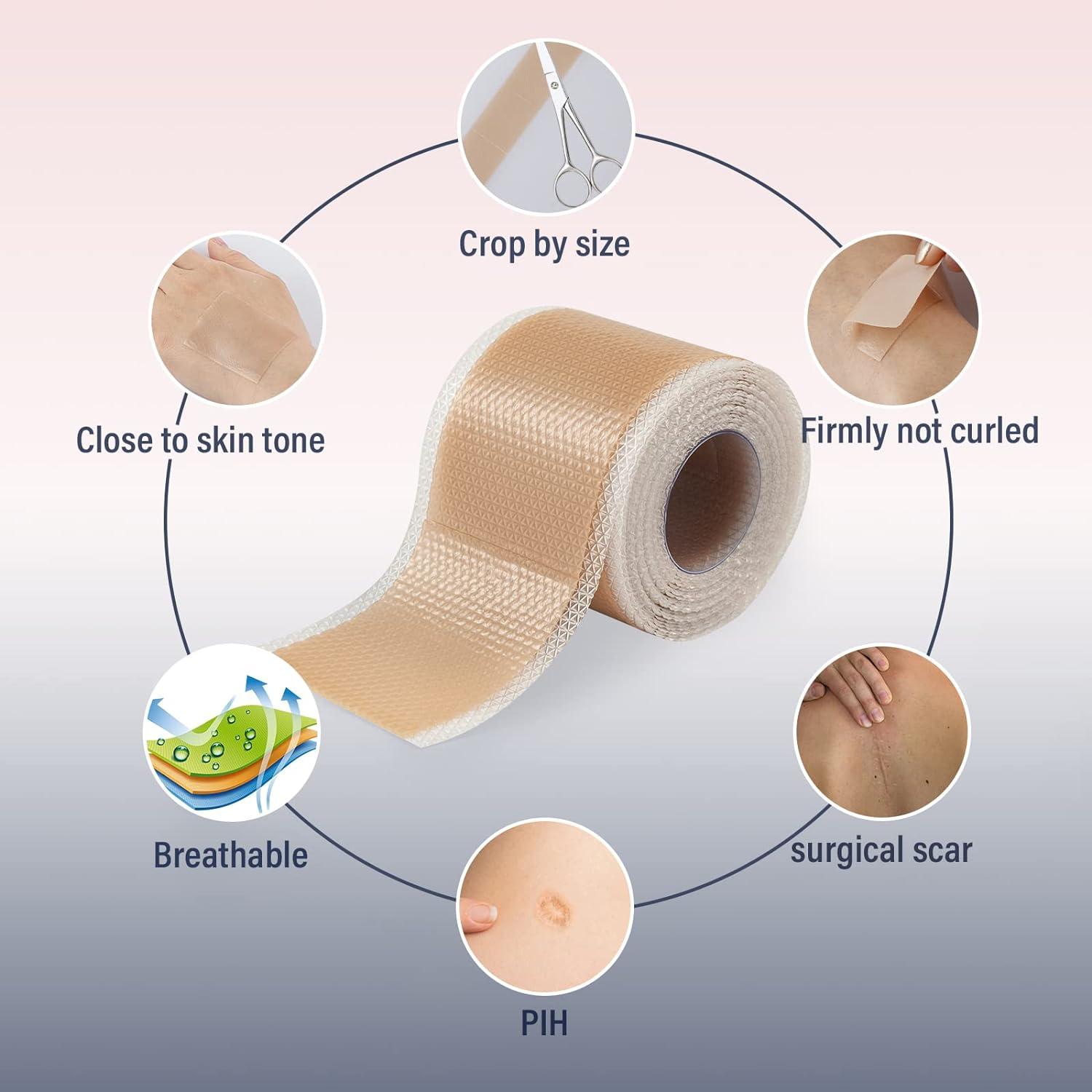 Silicon Scar Sheets (4cm*3m) Nude Color Silicone tape Scar Tape Silicon Scar Tape