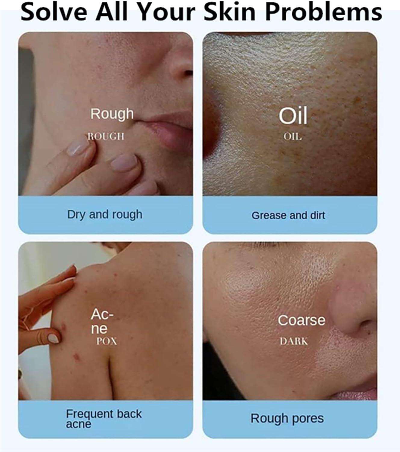 Ginbi Mud Rub Mud Rubbing Artifact Gel Rubbing Mud for Skin Mud Scrub ...