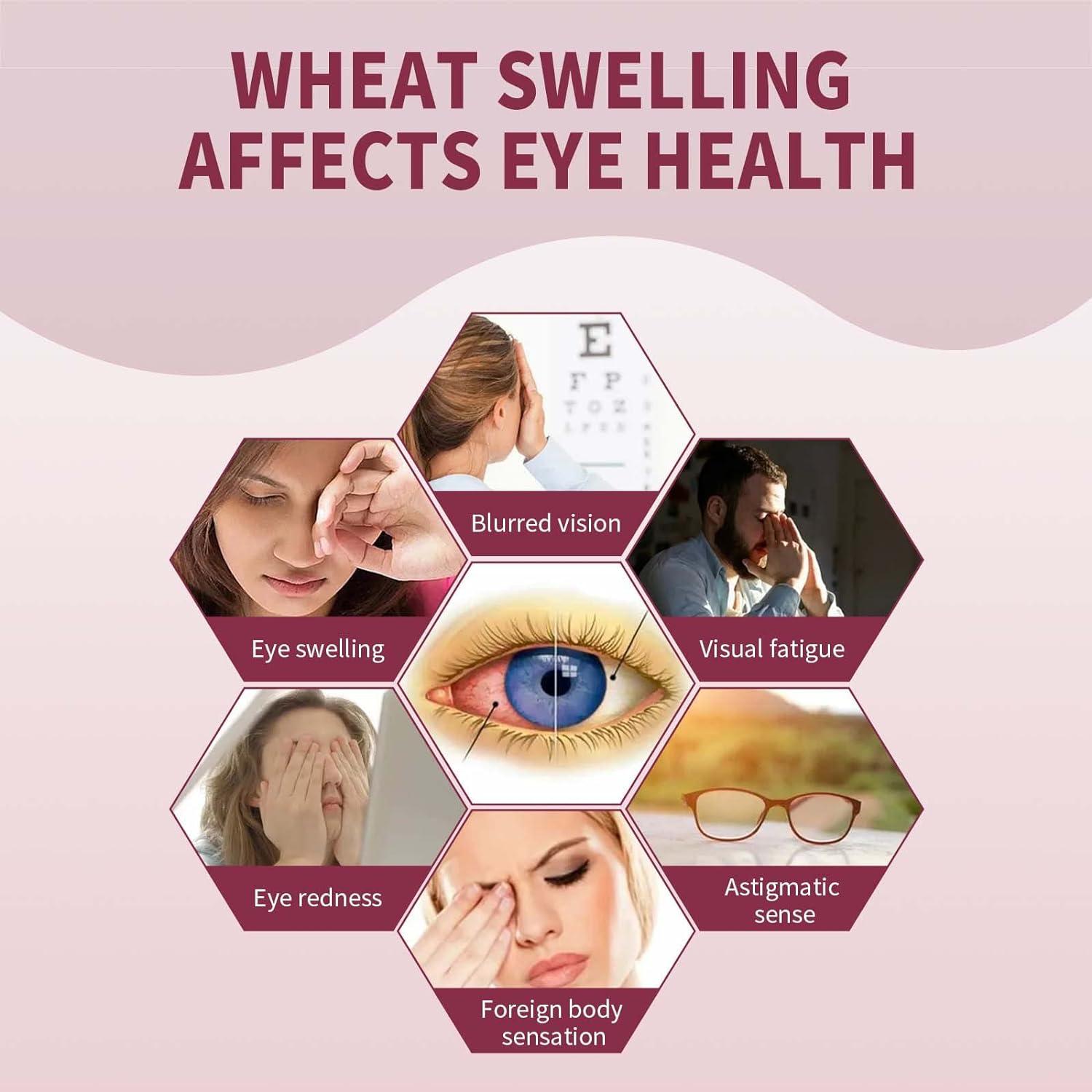 Stye Eye Treatment Serum - Fast Relief for Styes, Chalazion ...