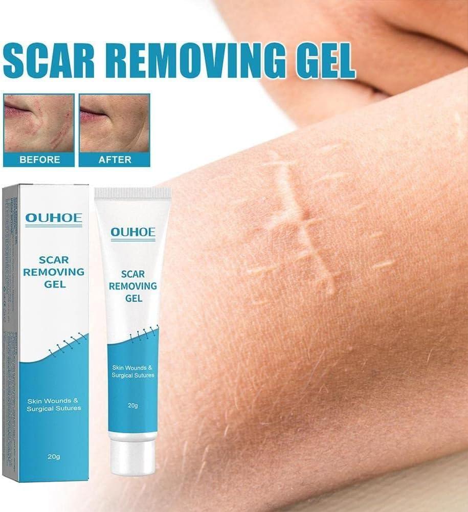 Waitlover Scar Removal Cream Gel - 20g | Repairs Pock Marks, Burns ...