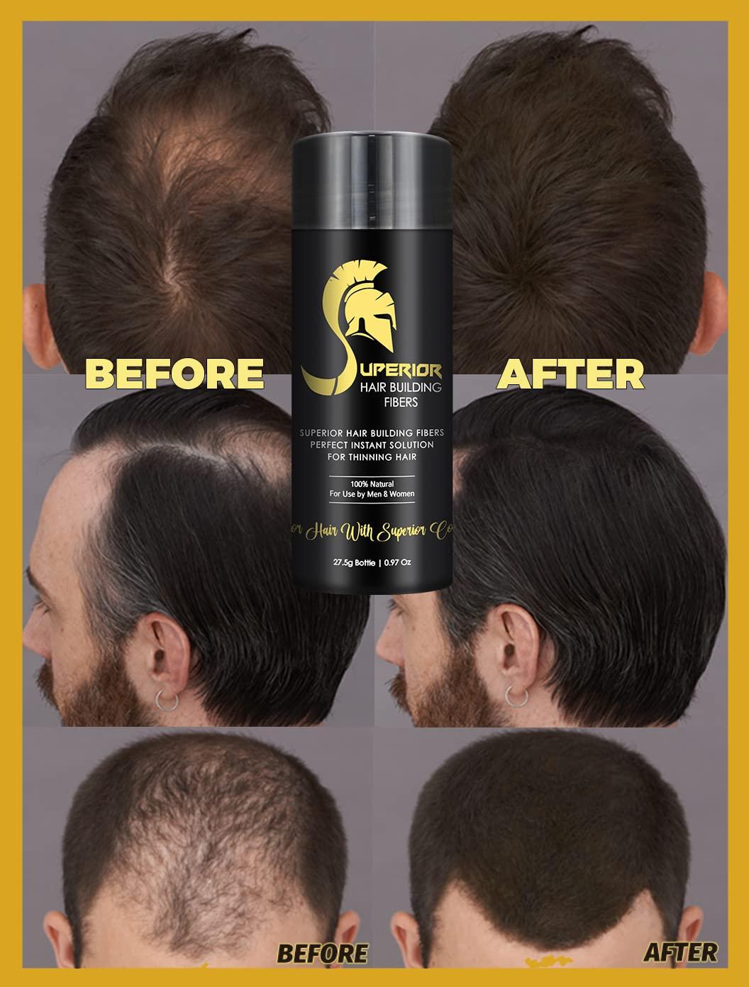 Natural Keratin Hair Fibers for Thinning Hair - Dark Brown 27.5g - Hair ...