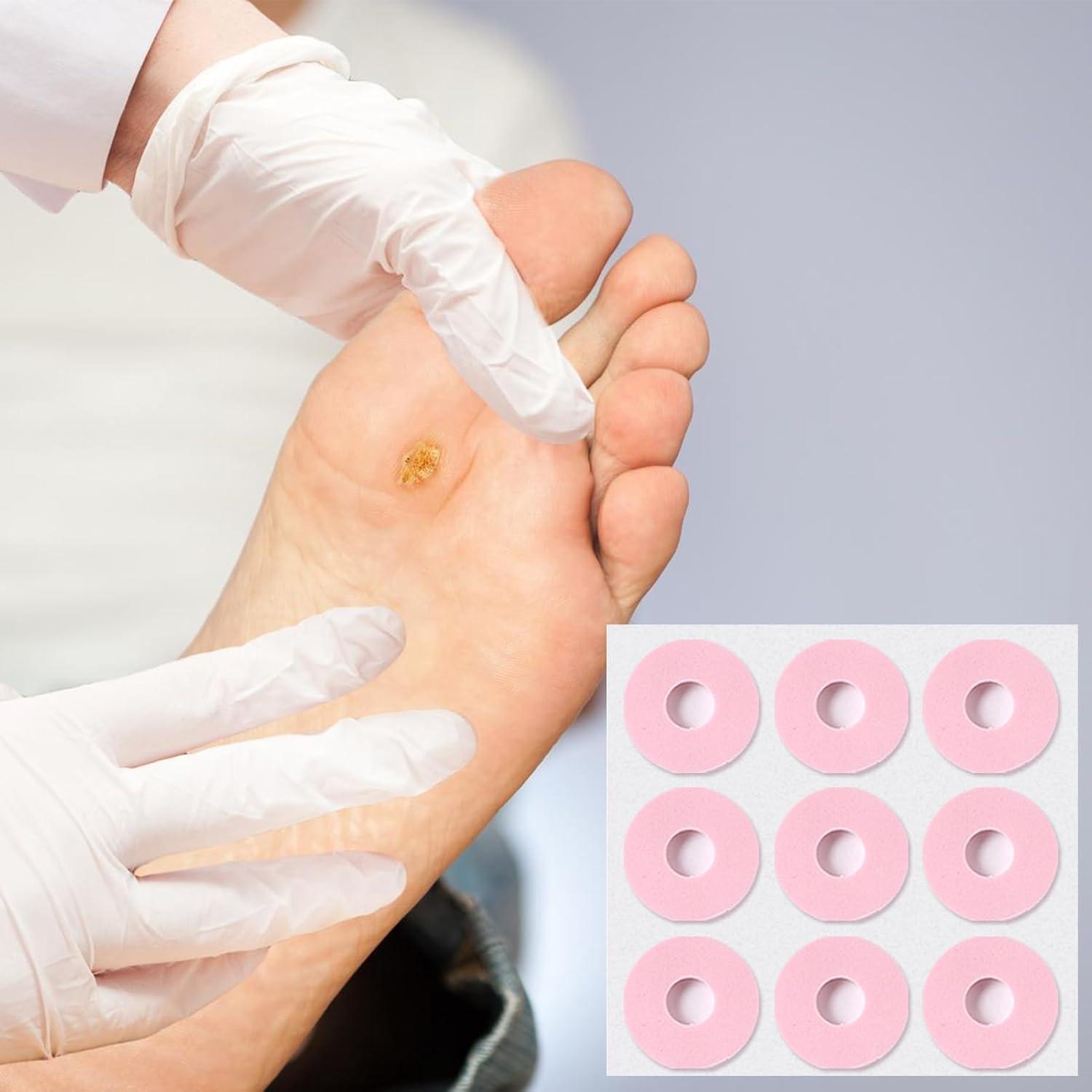 Corn Removers For Toes Foam Corn Pads | Corn Patches Foot Toes Corn ...