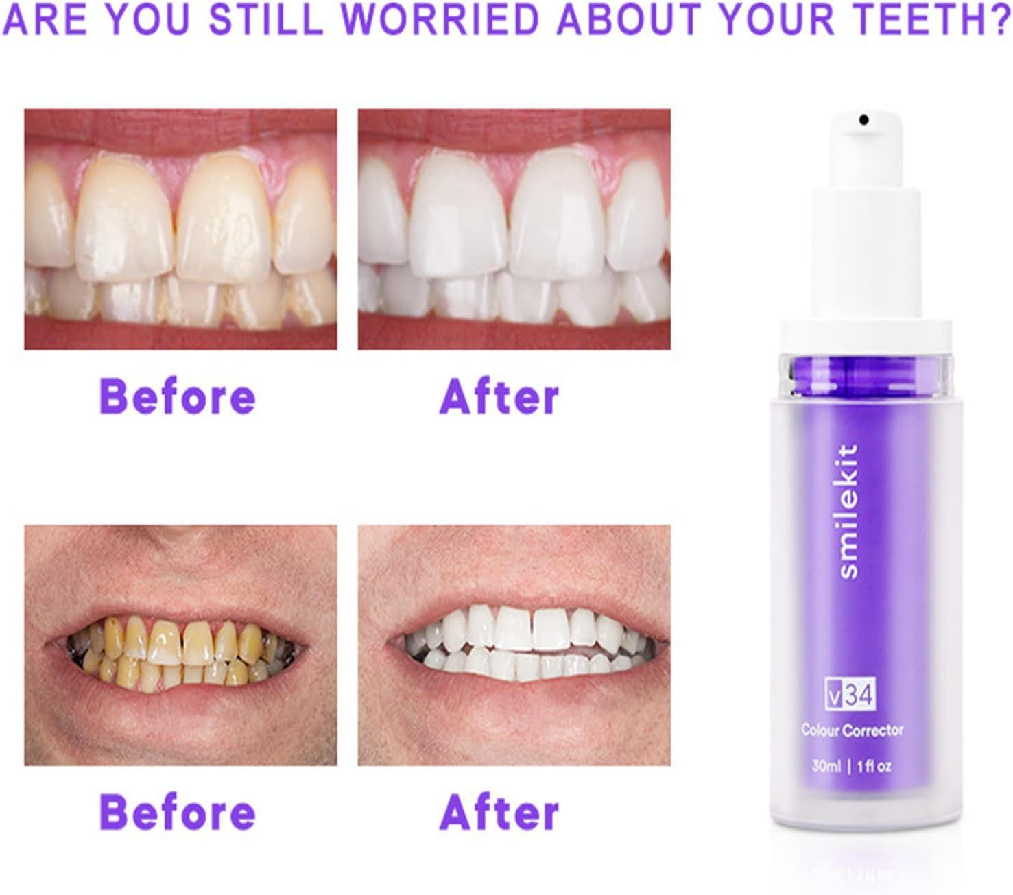Purple Toothpaste for Whiter Teeth | Violet Whitening Toothpaste (2PC ...