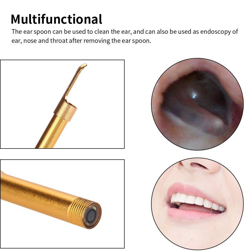 3-in-1 Earwax Removal Kit with Endoscope | Ear Pick & Cleaner | HD ...