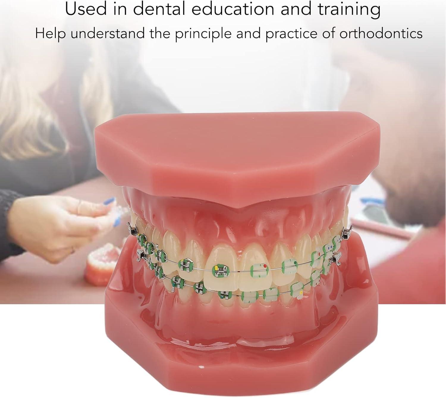 Orthodontic Bracket Model - Dental Resin Model & Portable Metal Wire ...