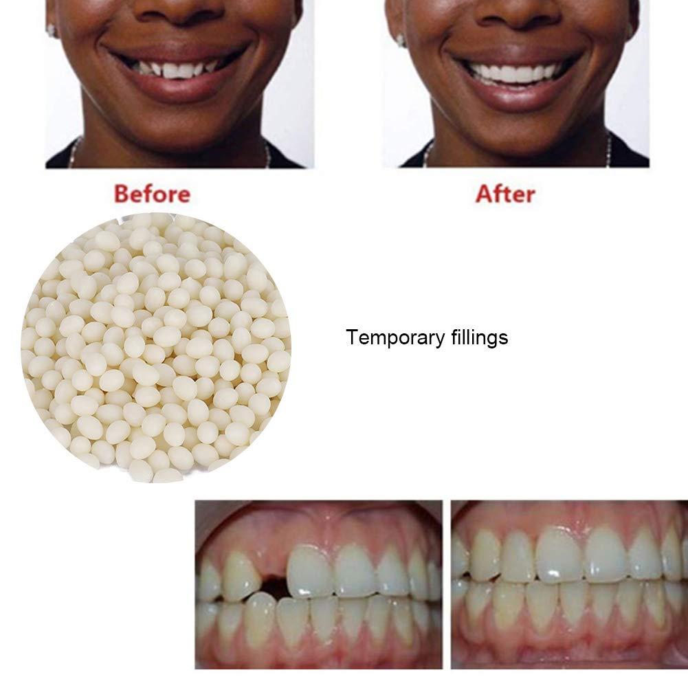 2pcs 50g False Teeth Solid Glue Kit - Temporary Tooth Replacement ...