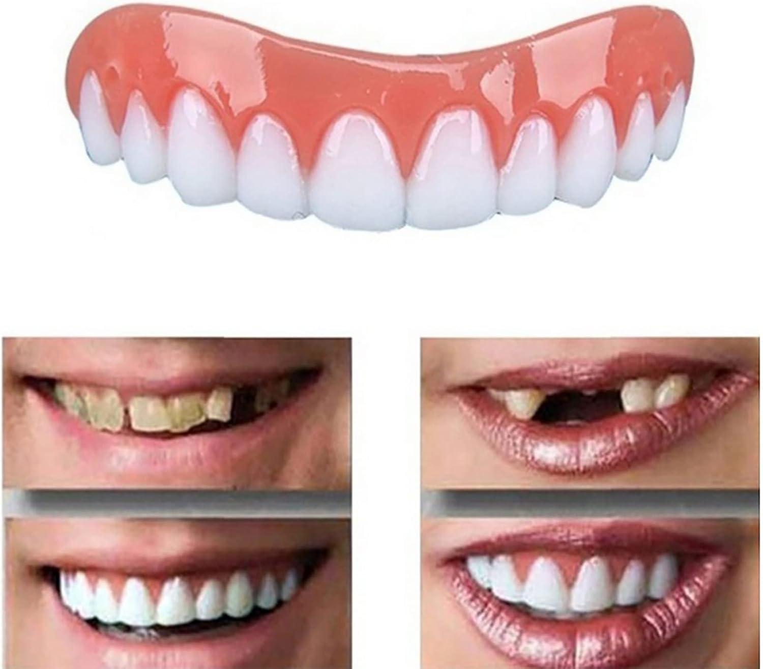 Adjustable Denture Set with Artificial Upper & Lower Teeth | Eat ...