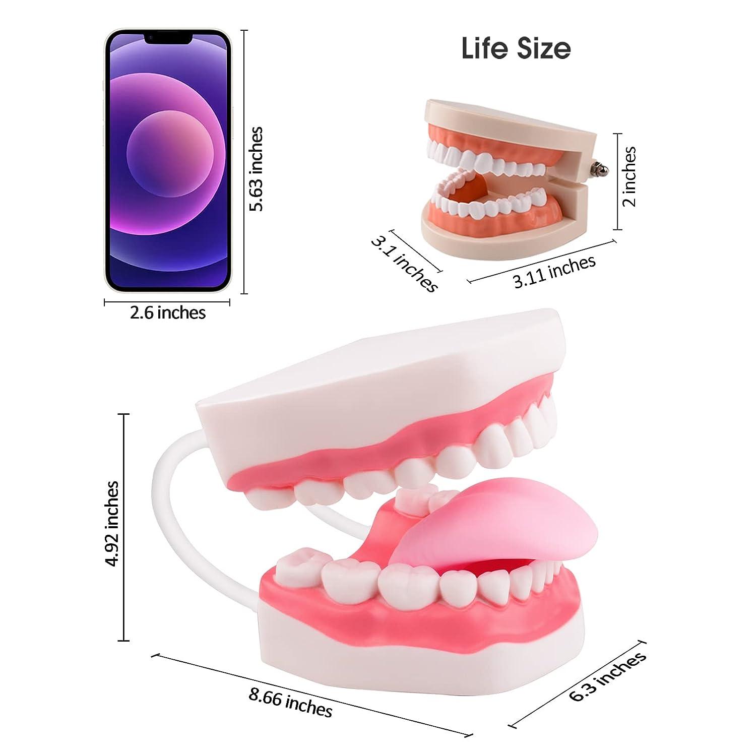 Ultrassist 6 Times Enlarge Mouth Model White Hinge for Speech Therapy ...