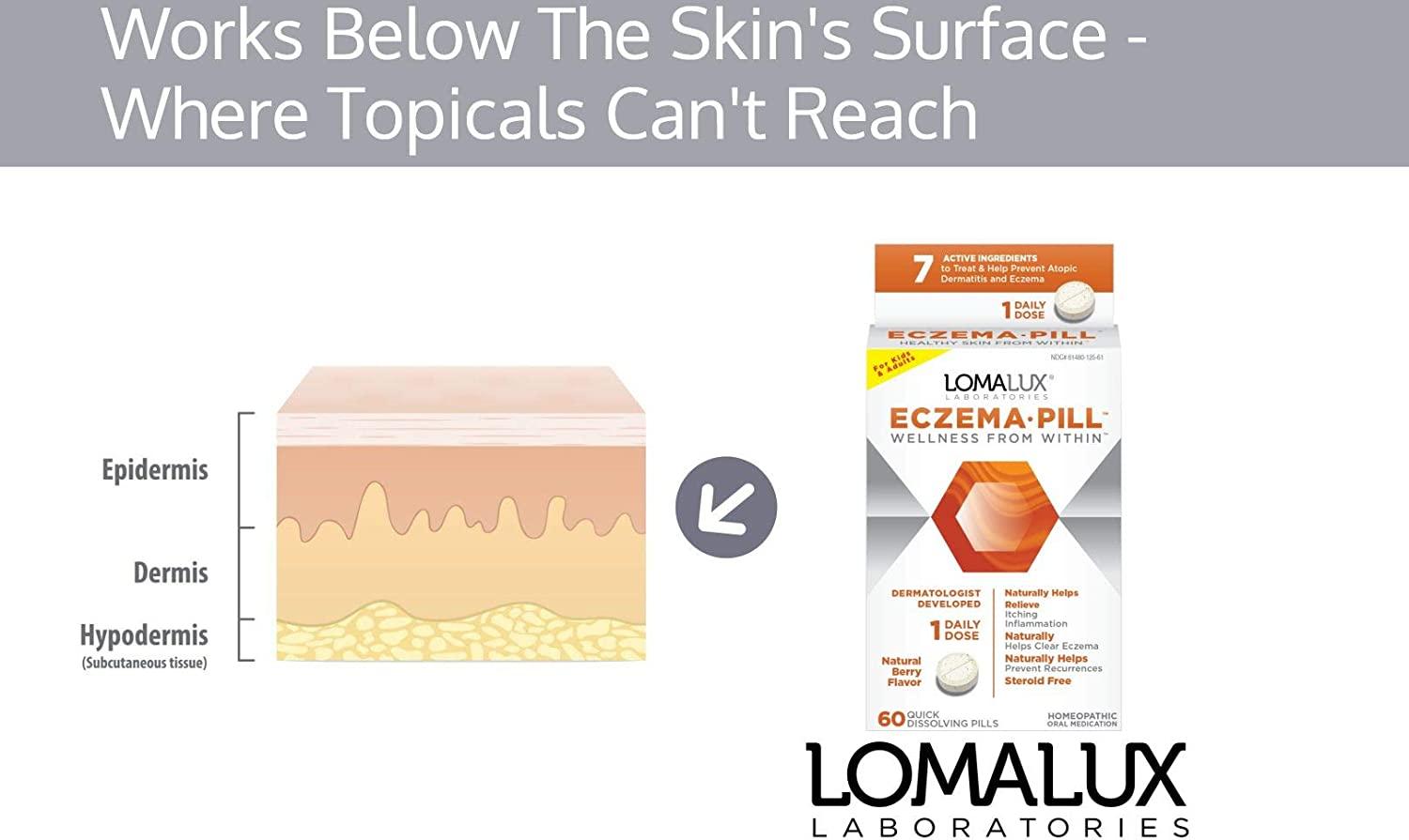 Loma Lux Eczema Pills - Natural Treatment for Skin Itch & Inflammation ...