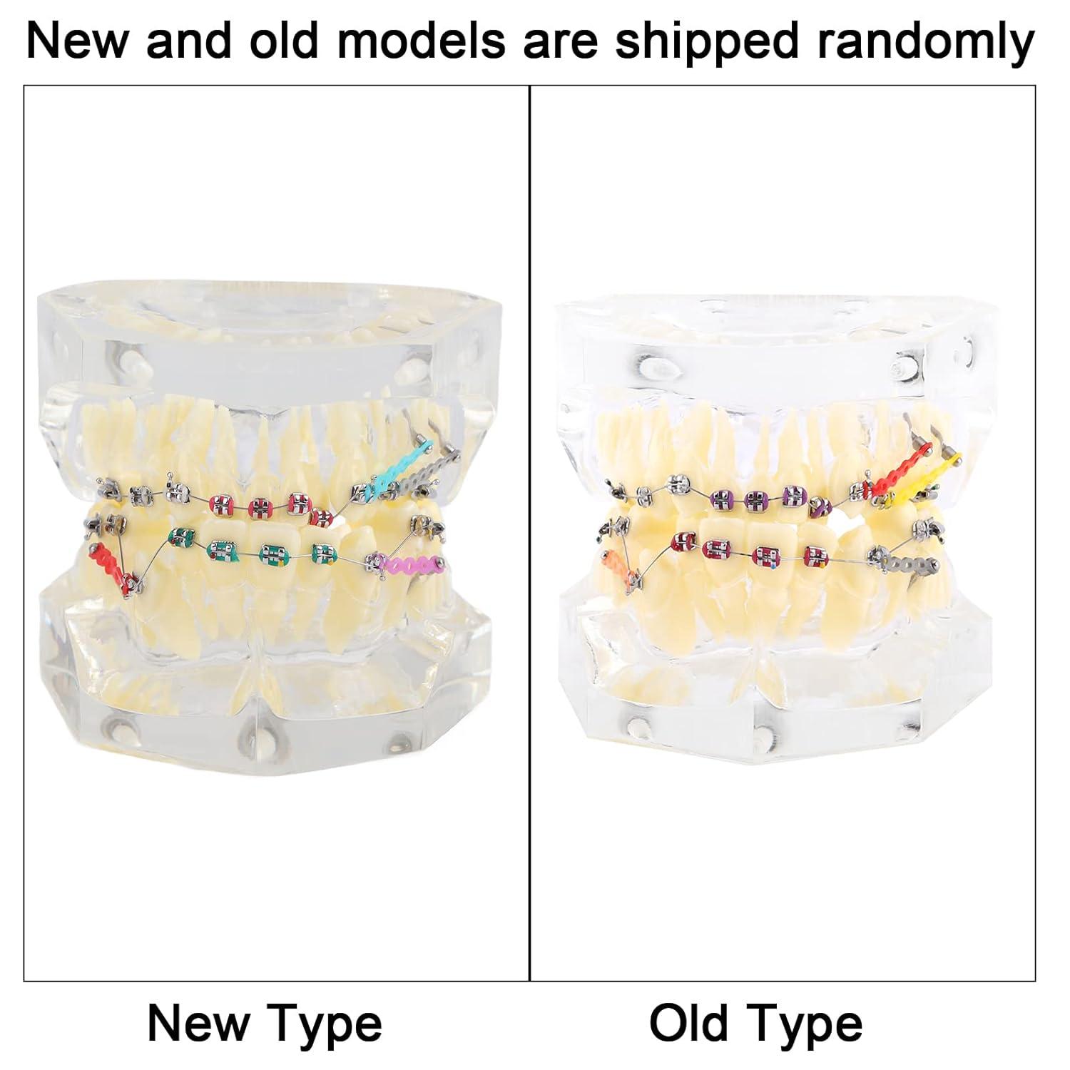 Dental Orthodontic Treatment Model - PVC Frame & Resin Teeth ...