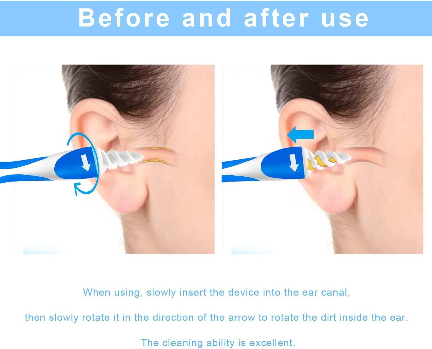 Q Grips Ear Wax Remover Kit - Soft Spiral Design with 16 Replacement ...