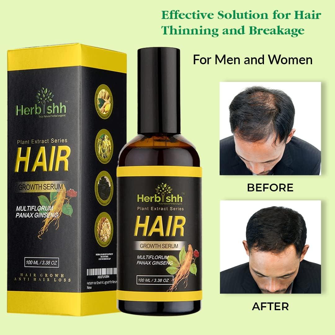 Herbishh Hair Growth Vitalizer Serum | Anti-Hair Loss & Thinning ...
