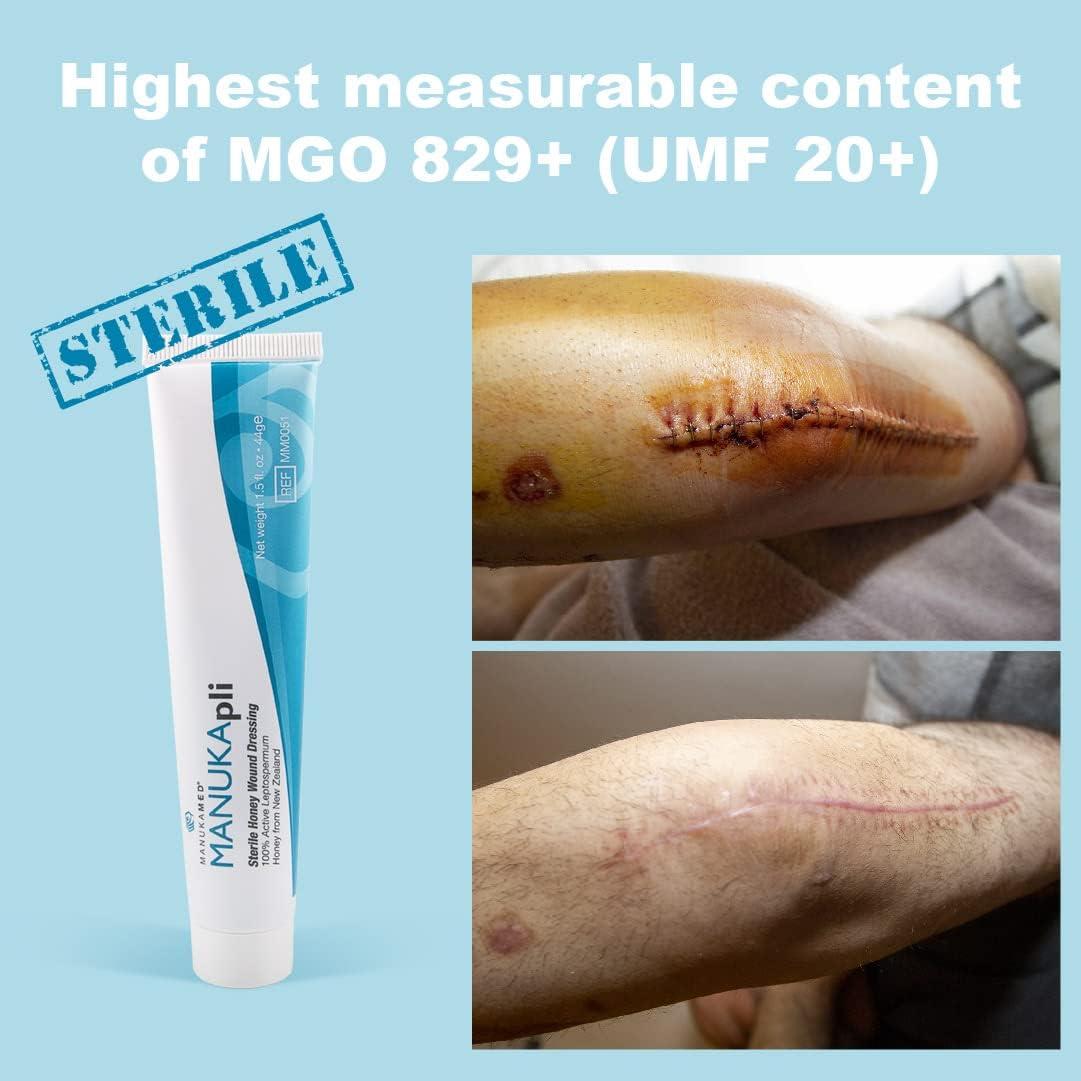 ManukaMed MANUKApli Sterile Wound Dressing with Pure Medical Manuka ...