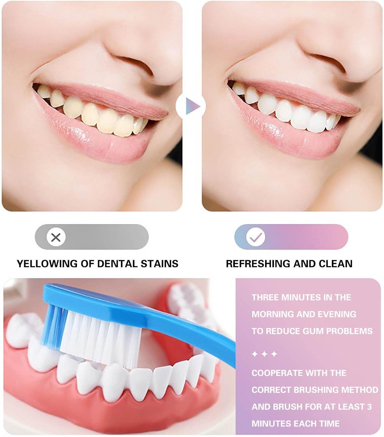 Nicotinamide Dazzle White Toothpaste - Probiotic Stain Removal ...