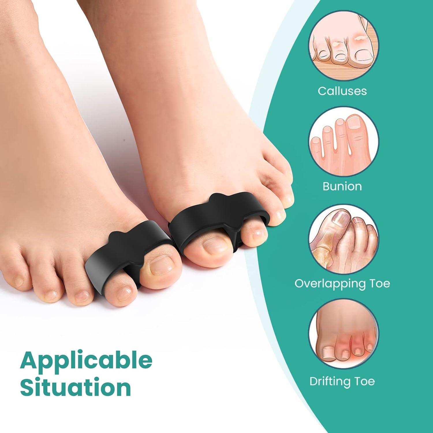 Welnove 8 Pack Bunion Corrector & Toe Spacer with Gel - Big Toe ...