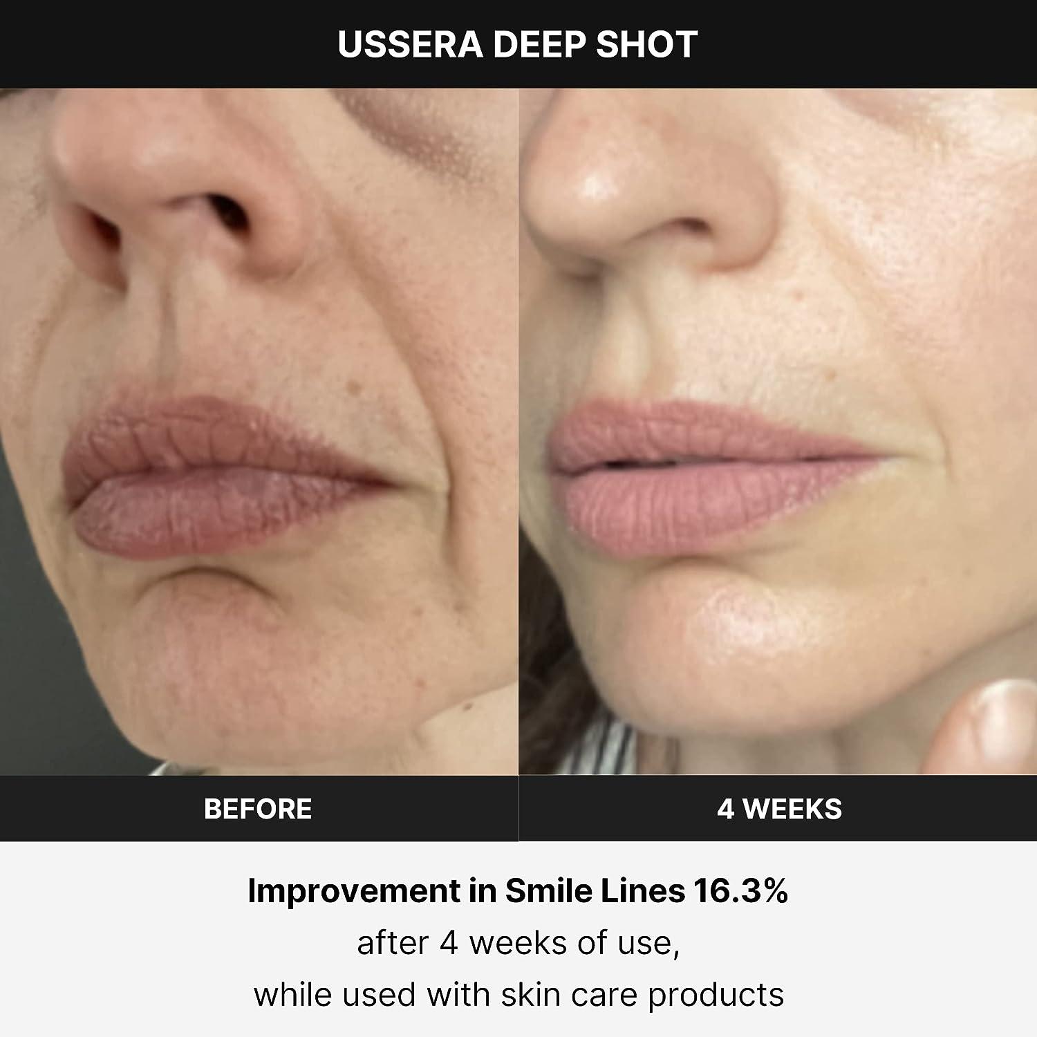 Medicube Age-R USSERA - Advanced Anti-Aging Device | Buy Now with ...