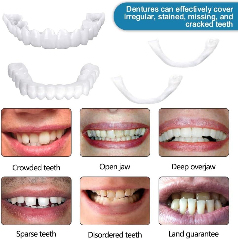 Buy 1 Pair of Immediate Veneers - Fake Teeth & Braces for Top & Lower ...