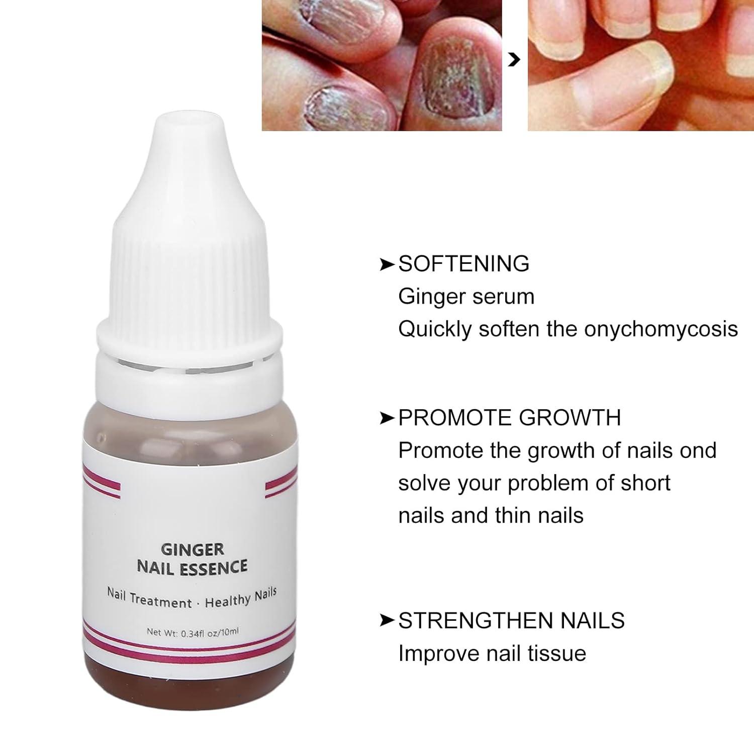 Ginger Nail Care Serum | Moisturizing & Nourishing Repair Treatment ...