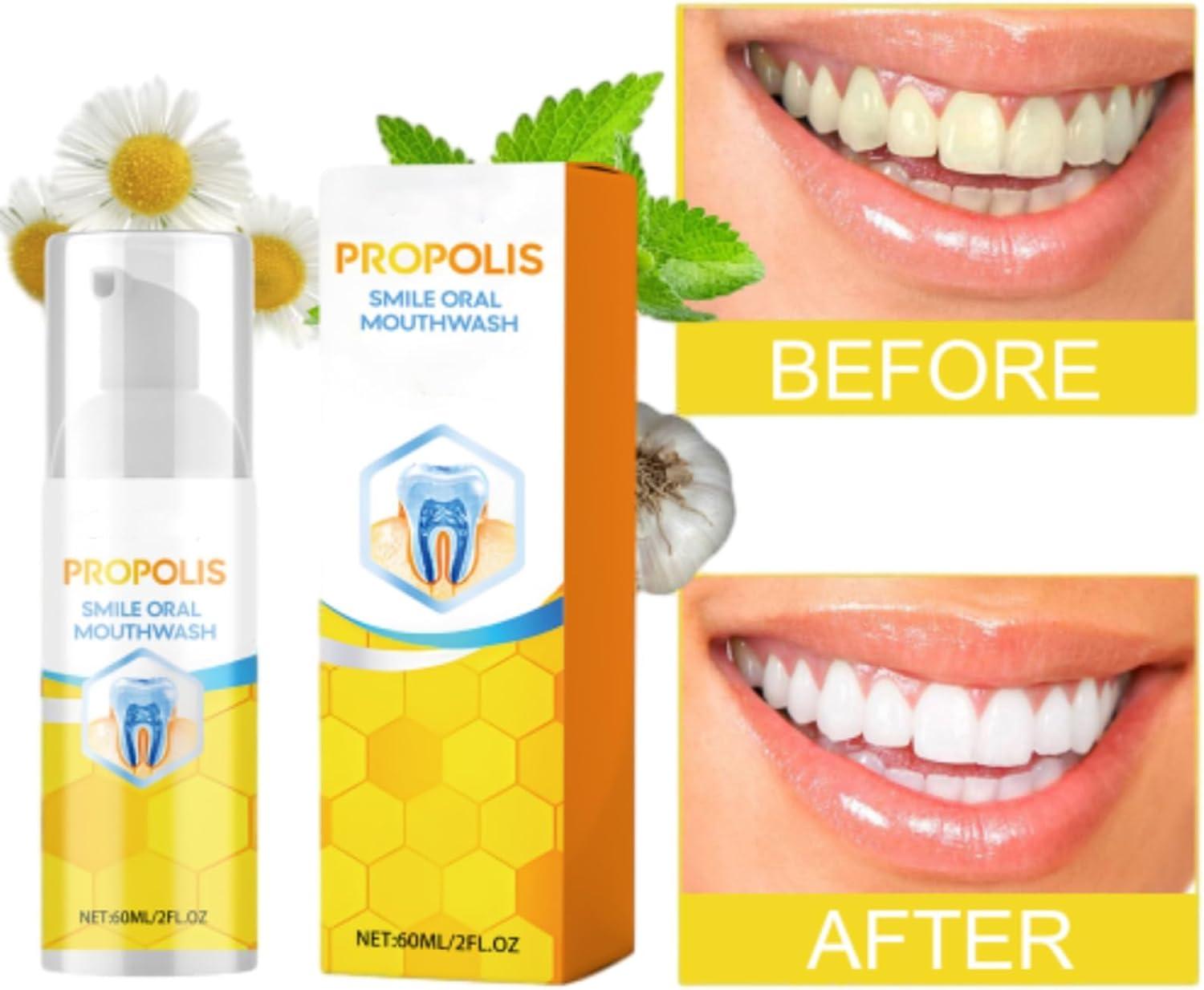 Propolis Smile Mouthwash - Total Care for Teeth & Gum Health ...