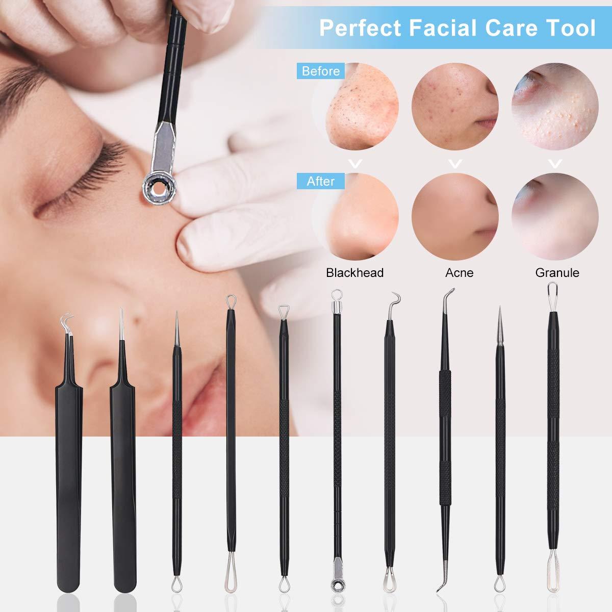 Fangze Pimple Popper Tool Kit - 10pcs Stainless Steel Blackhead Remover ...