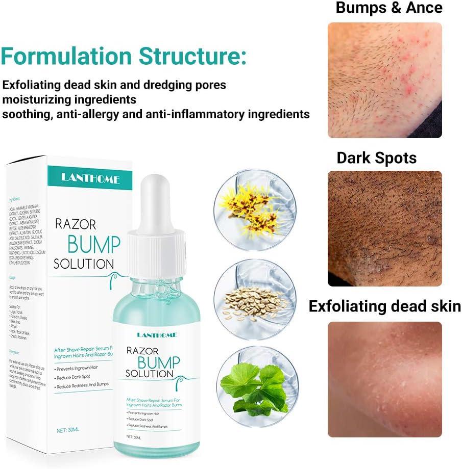 Razor Bumps Solution Skin Ingrown Hair Solution Bumps Reduce Redness ...
