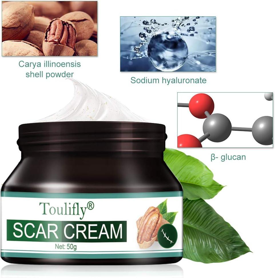 Scar Cream Silicone Scar Gel Scar Ointment Scar Cream For Old And New ...