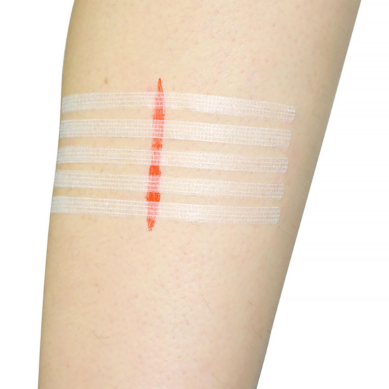 Buy Teqler Wound Seam Strip 6 x 100 mm | High-Quality Medical Supplies ...