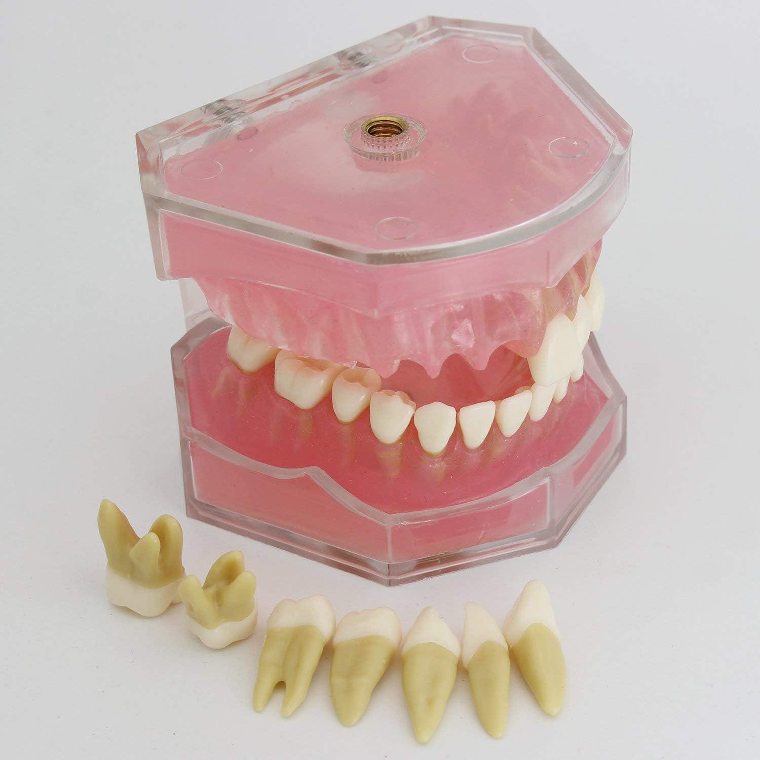 Samnuerly 28 Removable Teeth Dental Implant Model - Translucent ...