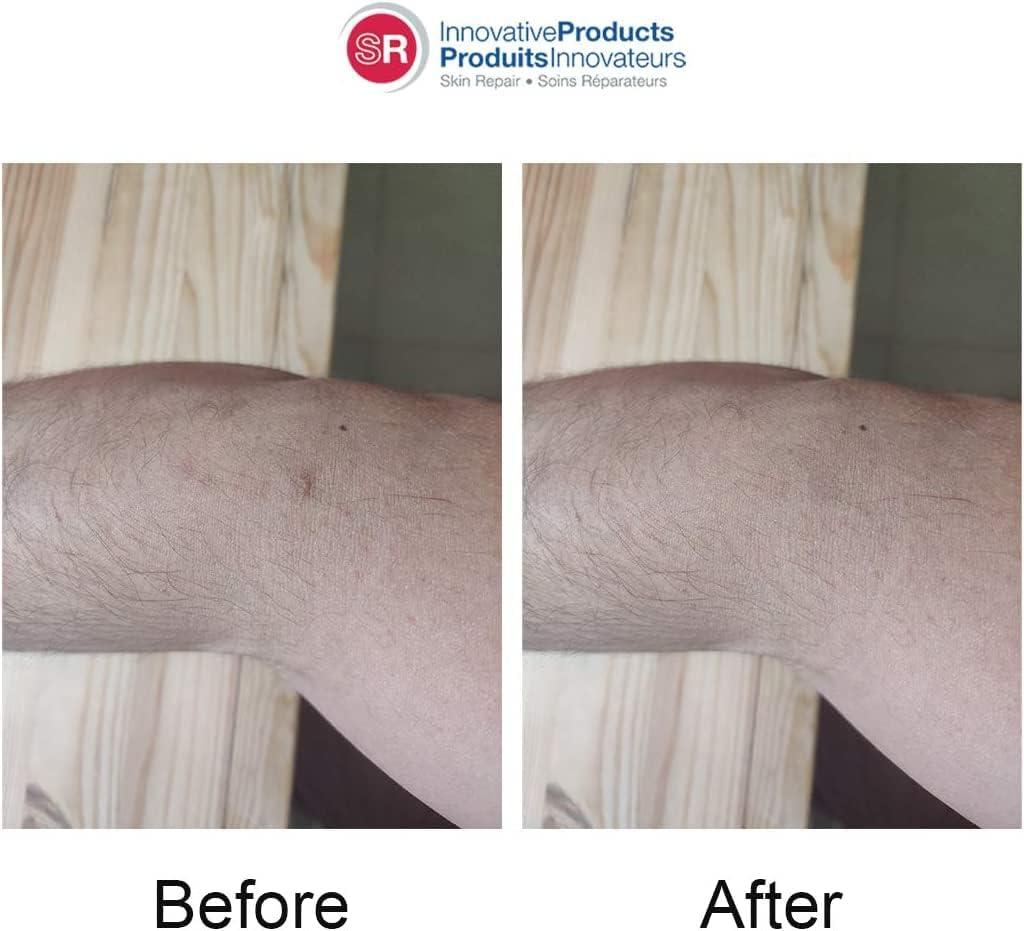 ScarFix 15ml: Skin Repair Solution & Scar Treatment Cream | Buy Now ...