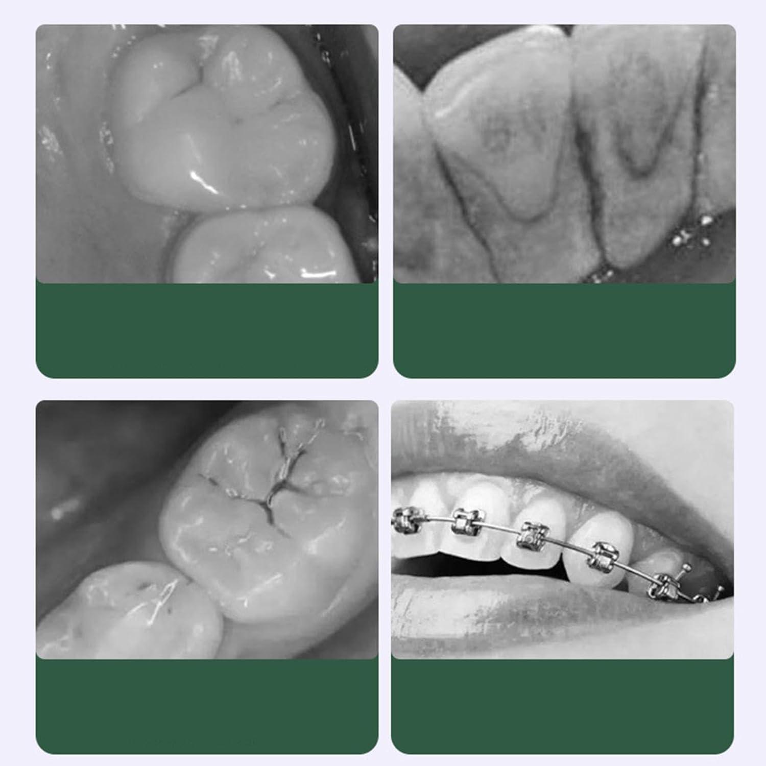 Soft Trim Dental Brush for Orthodontic Care | Compact Interdental Brush ...