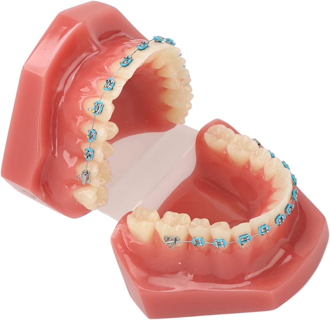 Typodont Orthodontic Tooth Model (28 Teeth) - Realistic Crowded Teeth ...