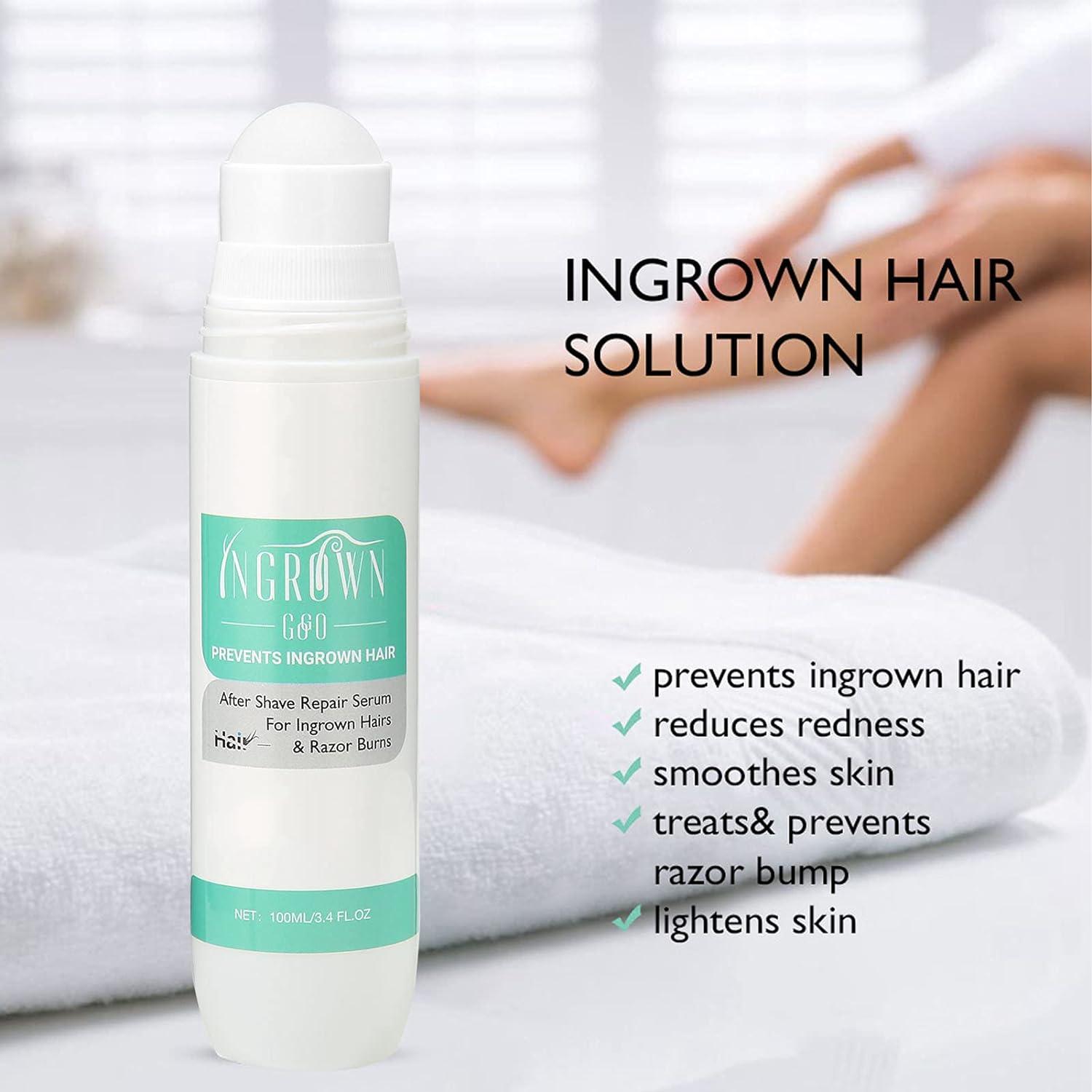 Razor Bumps Solution: 100ml Roll-on After Shave Repair Serum for Men ...