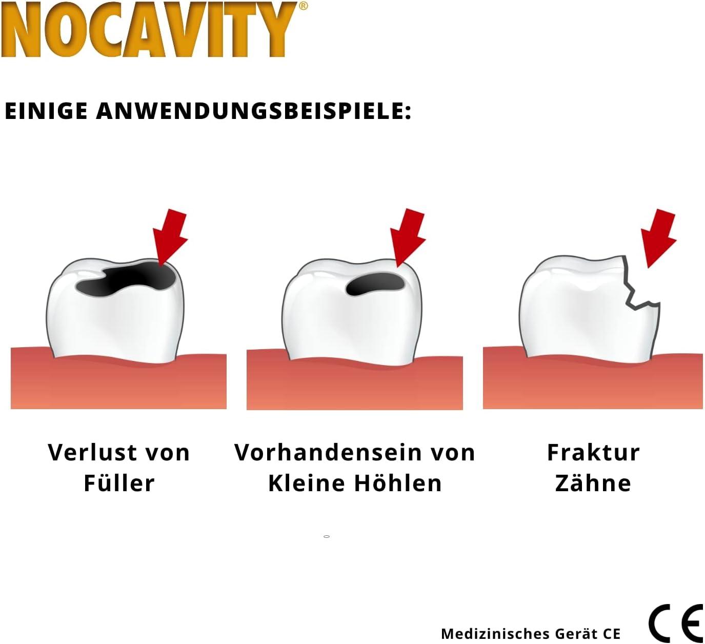 Nocavity Temporary Tooth Filling Set - Relief for Cavities Lost ...