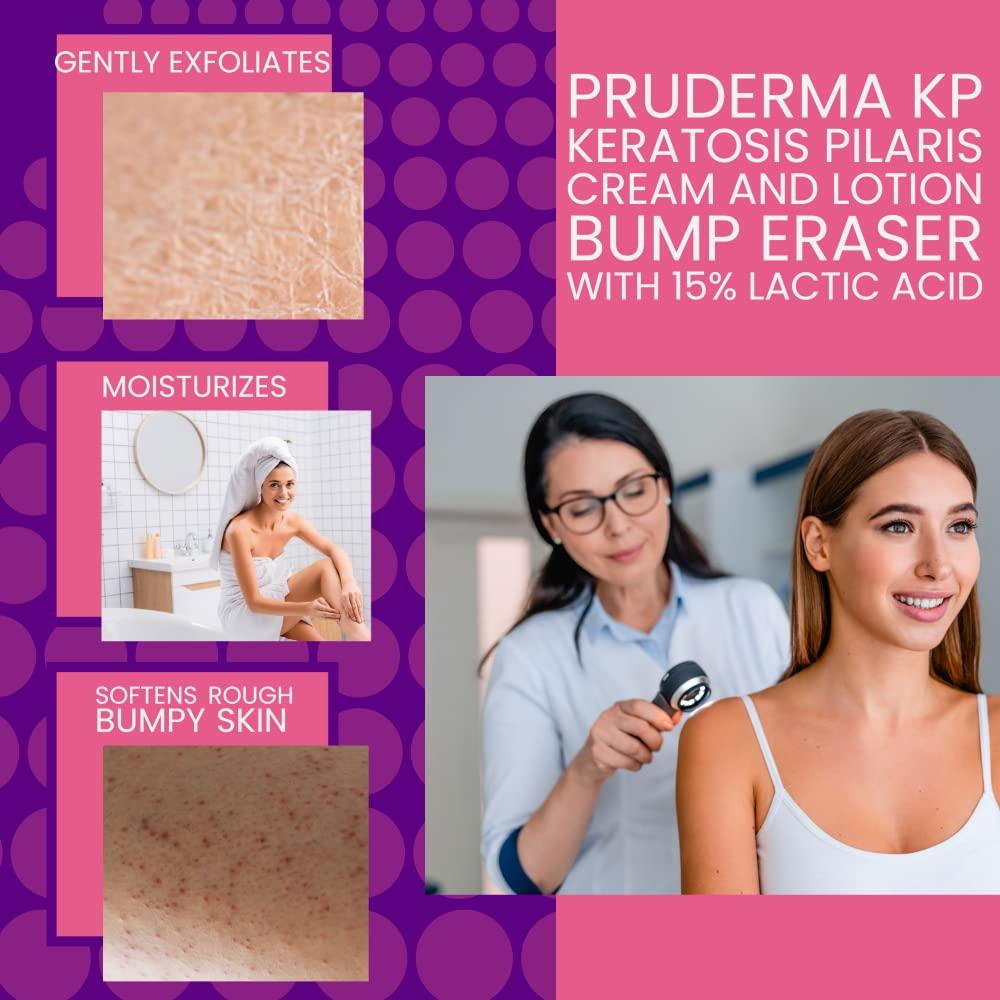 Pruderma KP Bump Eraser Hydrating Cream - 12 Oz | Bumps Be Gone for ...