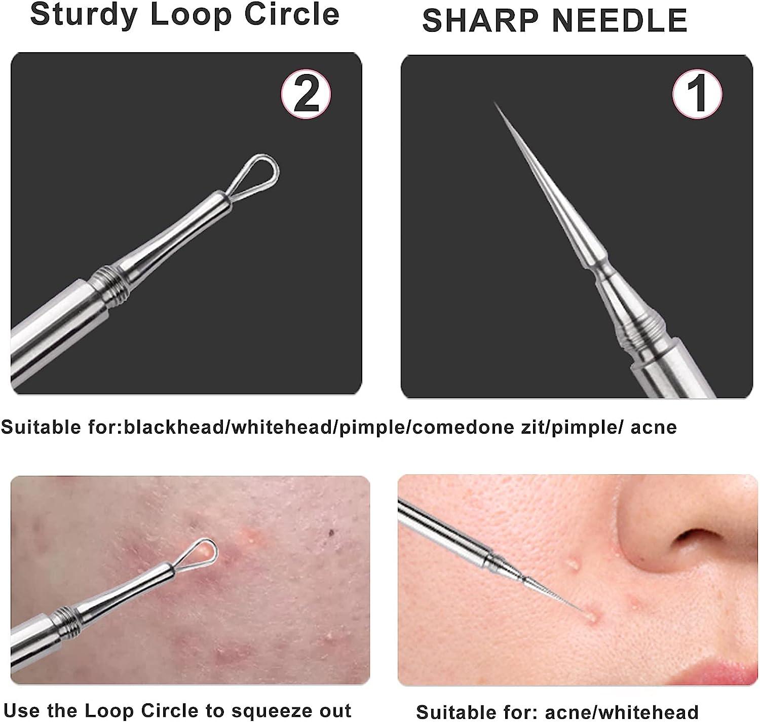 Professional Facial Milia & Whitehead Extractor Tool Set - Double Ended ...